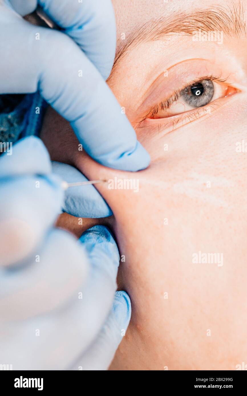 Vertical image format - The procedure for the introduction of the ...