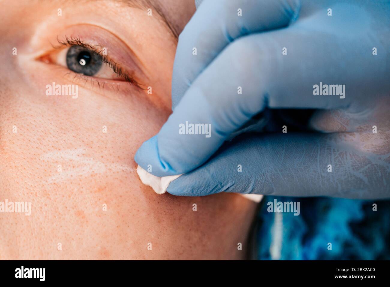 Cheekbone contouring is a safe, effective procedure that will help to ...