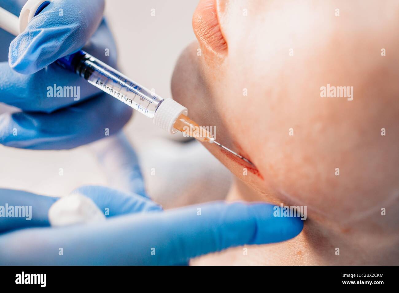 The procedure for the introduction of the active substance - under the ...