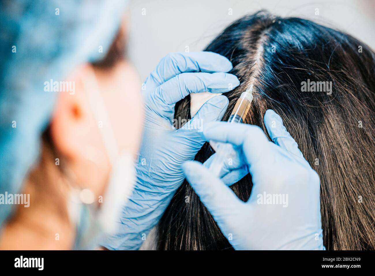 Cosmetology - plasma injection into the scalp - aesthetic medicine ...