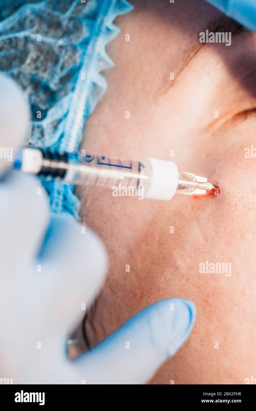 Vertical image format - Cheekbone contouring - the ideal solution in ...