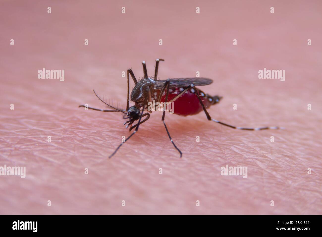 Bug bite skin hi-res stock photography and images - Alamy