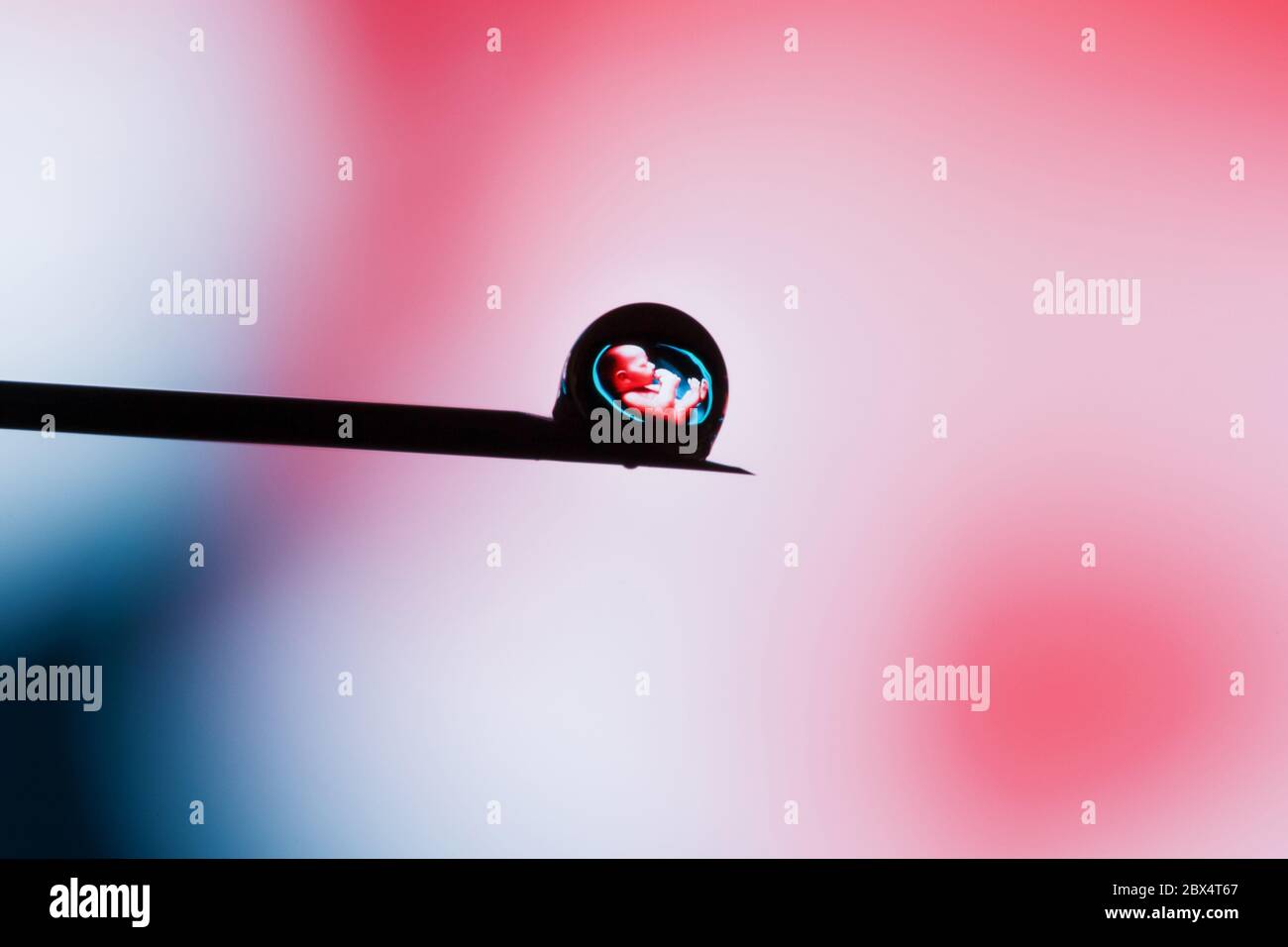 A human embryo on the tip of a needle. Artificial insemination Stock ...