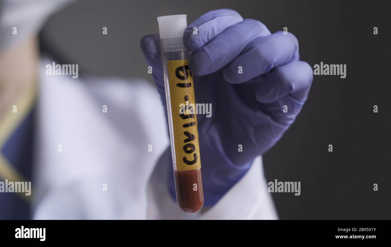 Lab worker with blood test tube of covid-19 test. Super close up shot ...