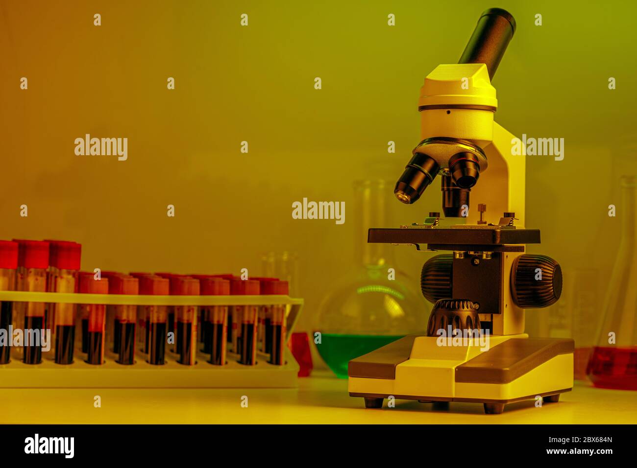 Close up photo of microscope with test tubes with blood samples Stock ...
