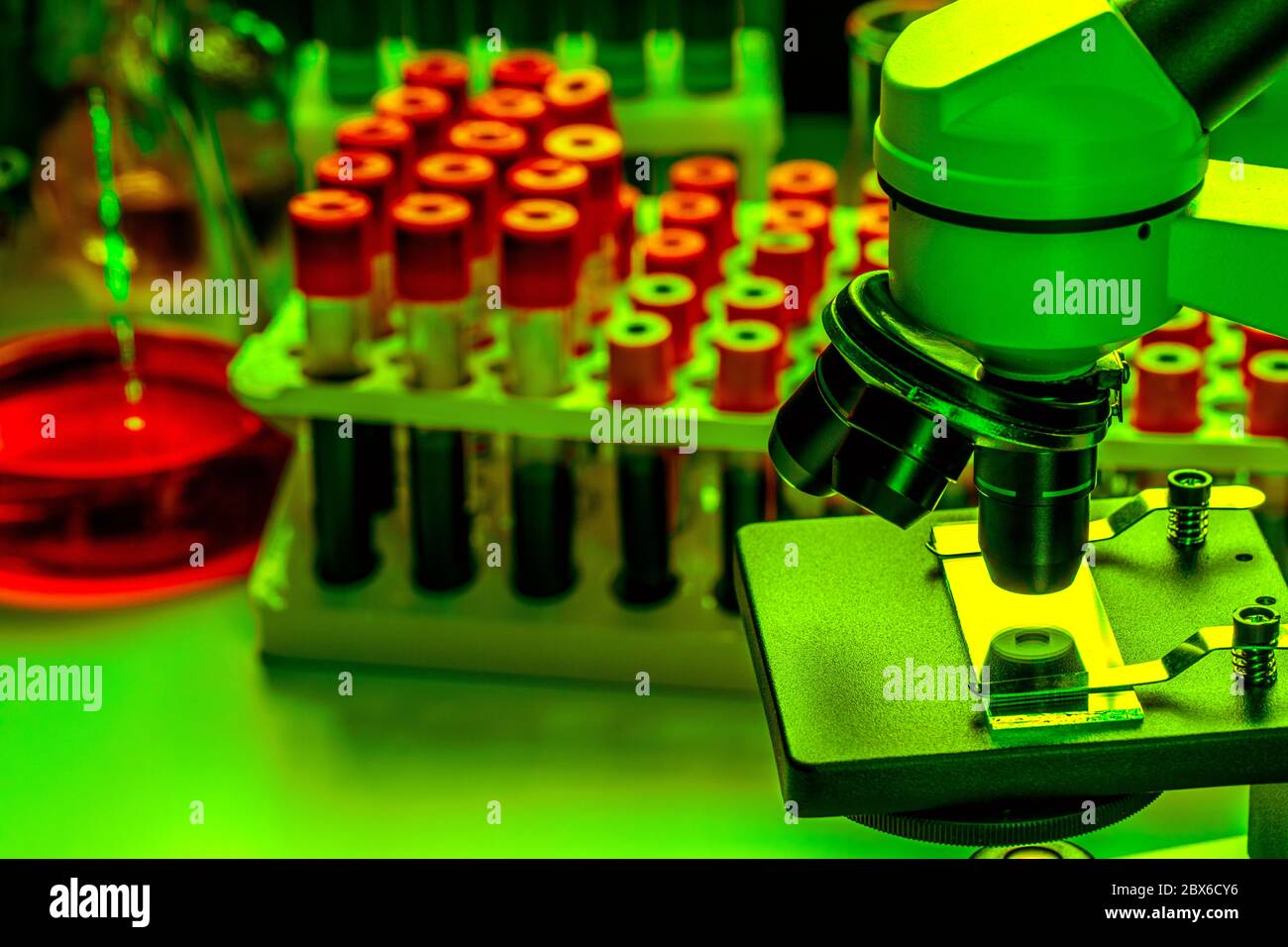 Photo laboratory microscope blood sample hi-res stock photography and ...