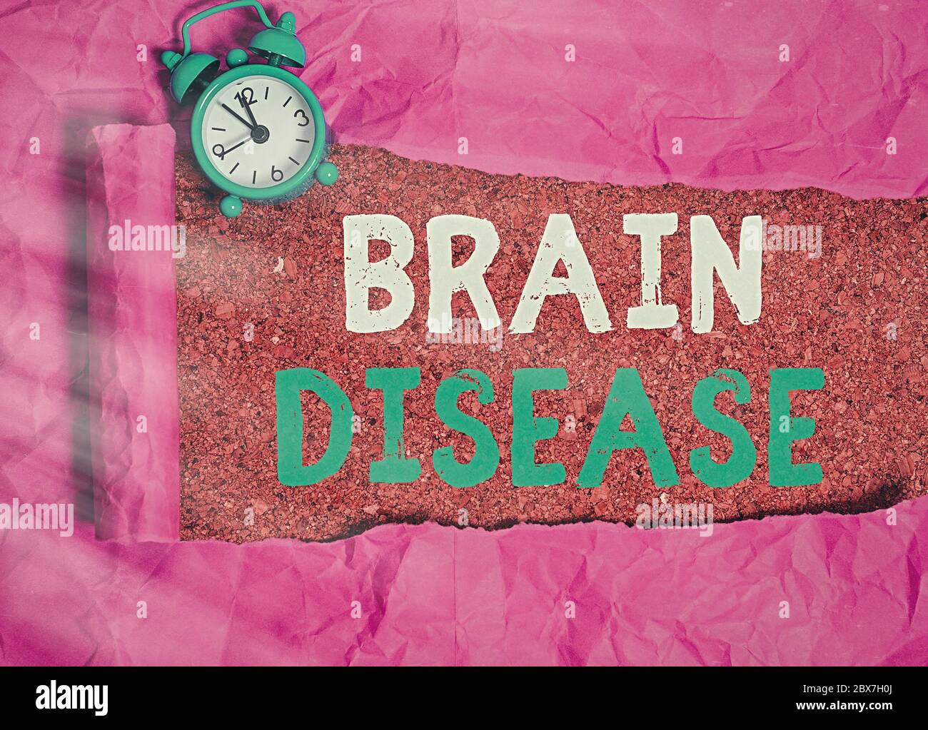 Word writing text Brain Disease. Business photo showcasing a ...