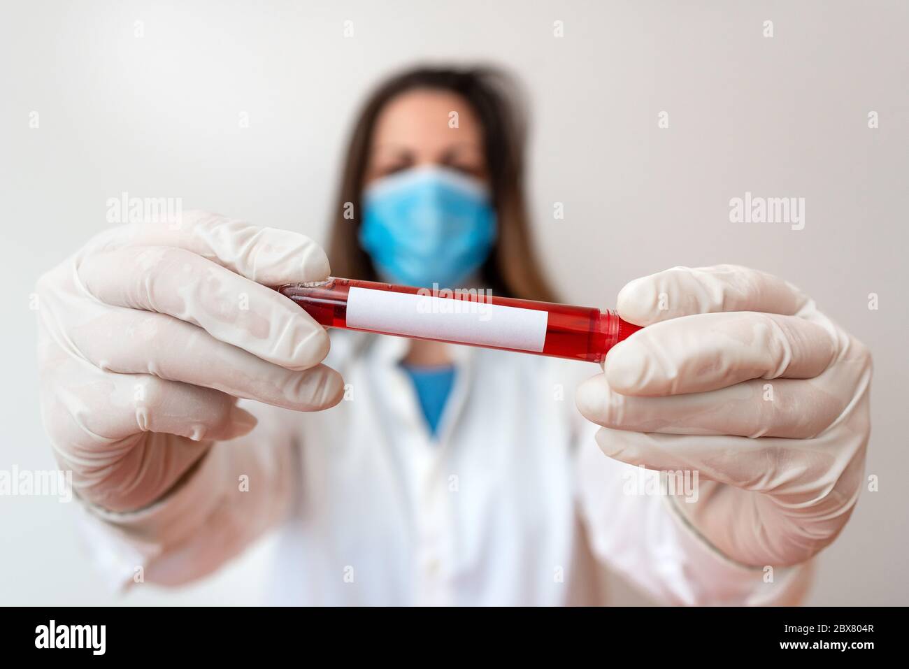 Laboratory Blood Test Sample Shown For Medical Diagnostic Analysis ...