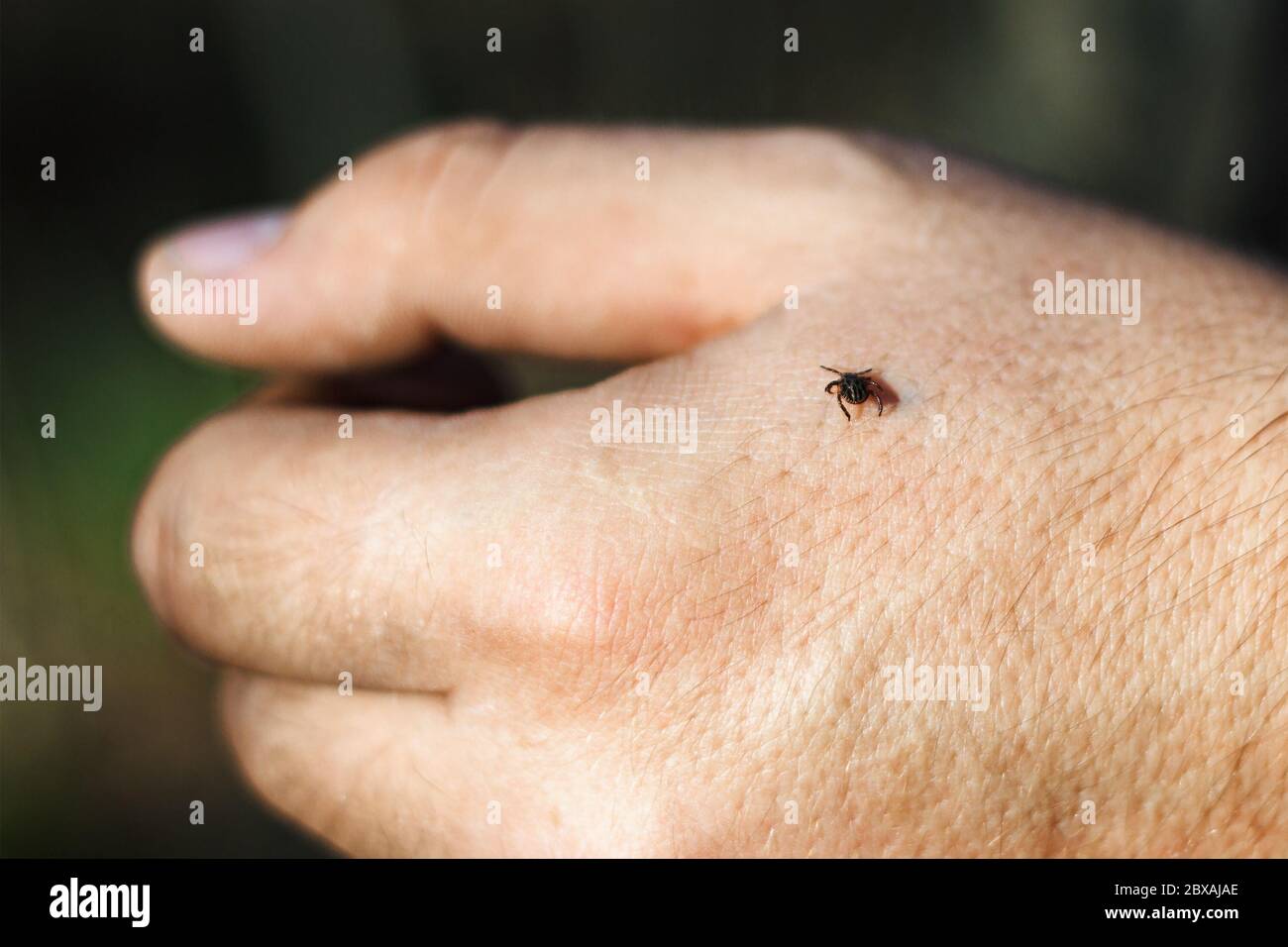 hard-bodied tick of the family Ixodidae on skin of human hand ...