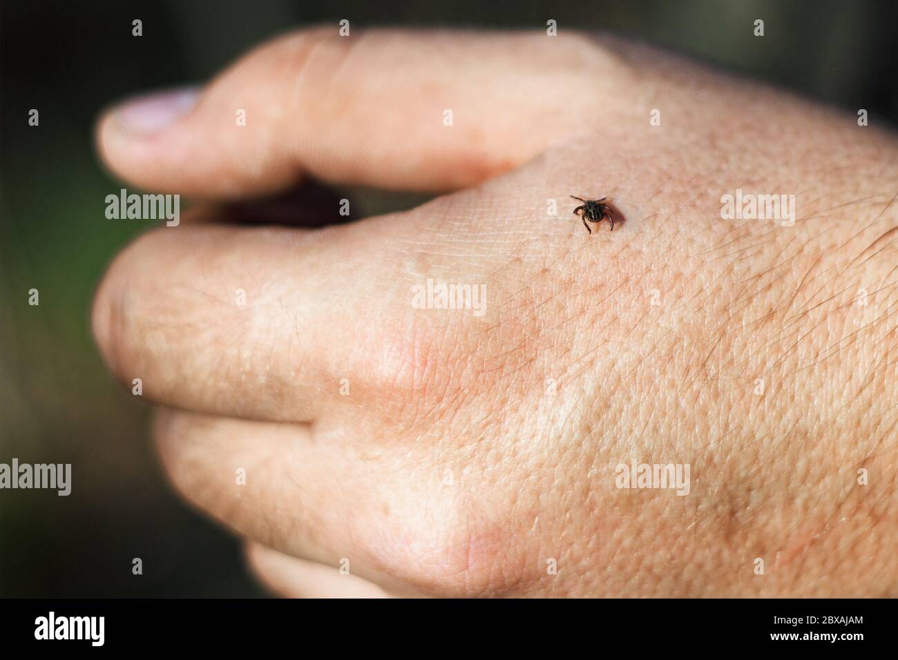 Tick on skin hi-res stock photography and images - Alamy