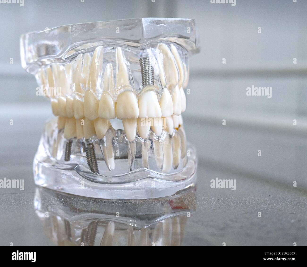 Acrylic human jaw model for studying oral hygiene Stock Photo - Alamy