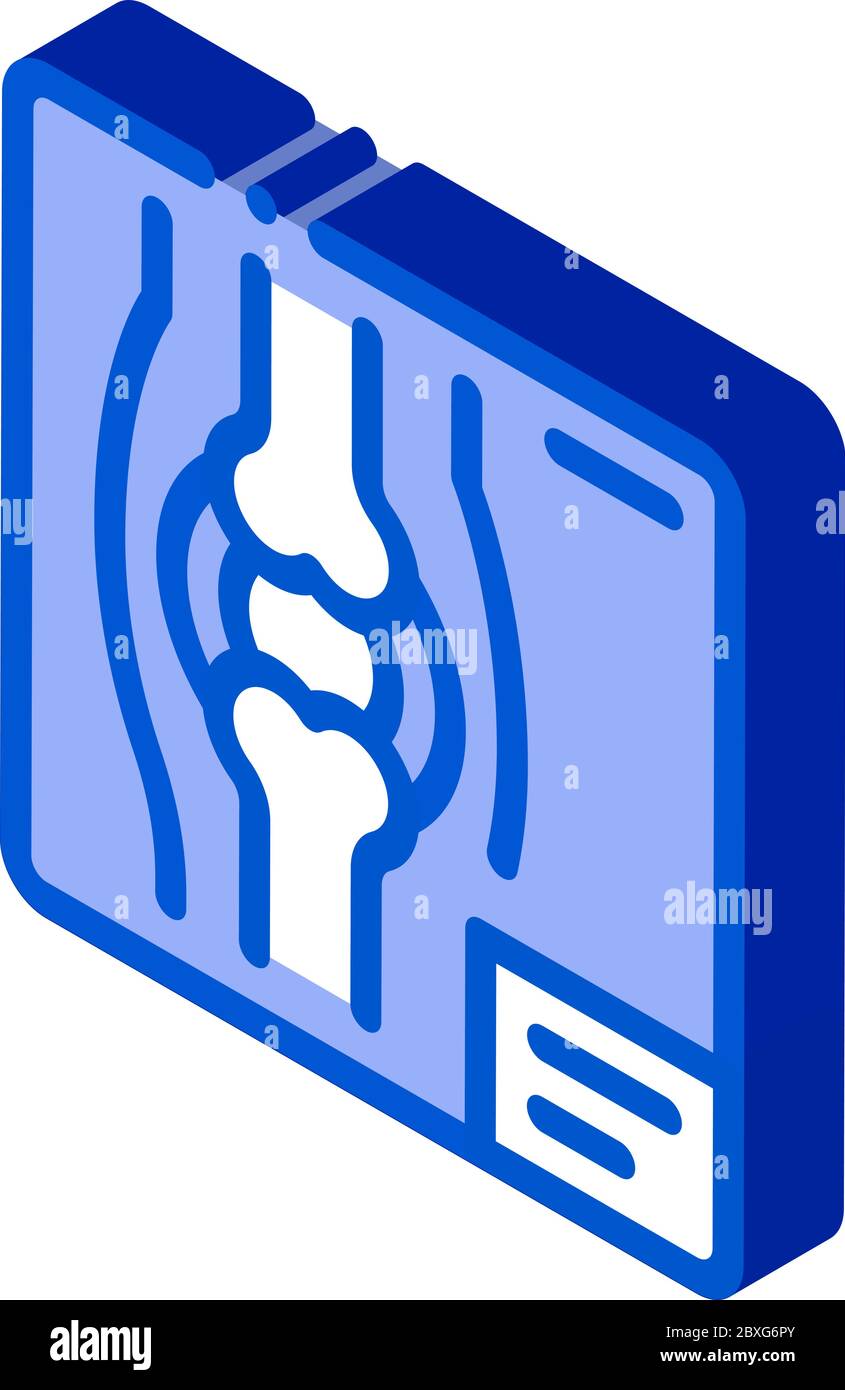 bone x-ray isometric icon vector illustration Stock Vector Image & Art ...