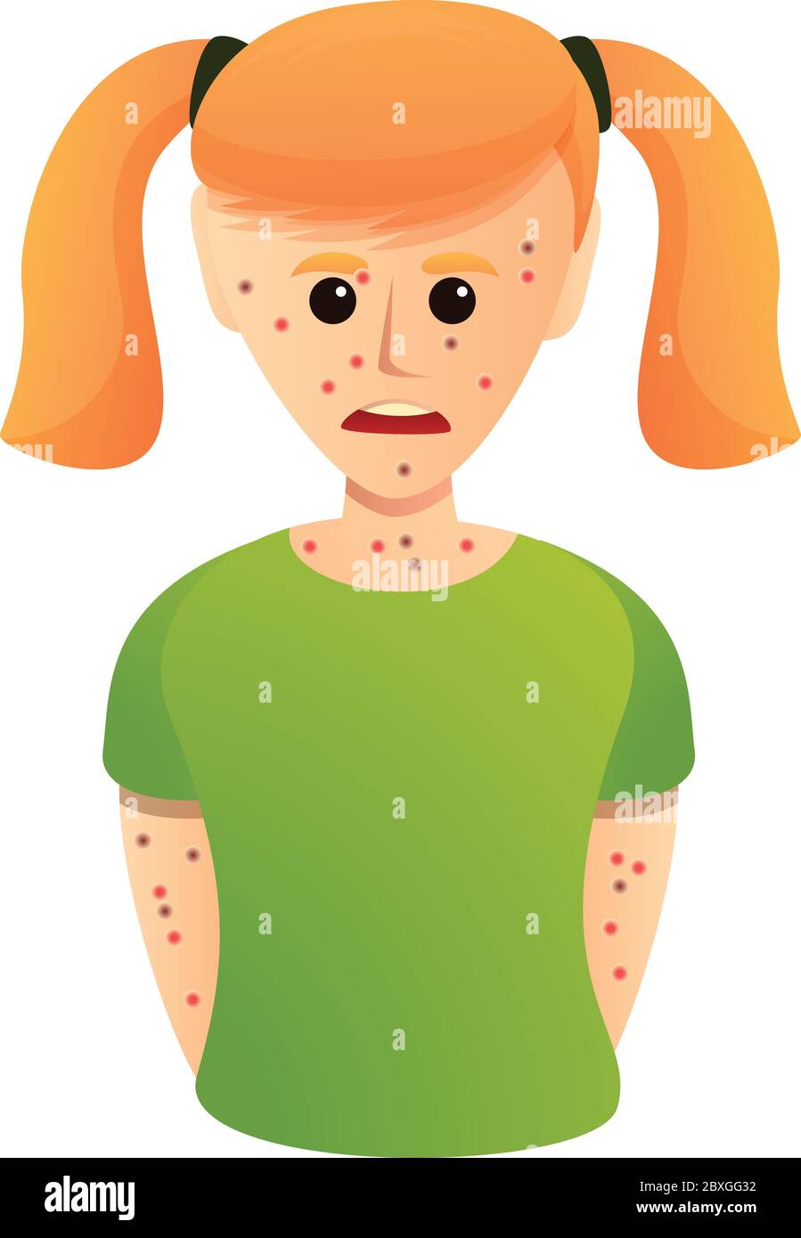 Patient with smallpox Stock Vector Images - Alamy