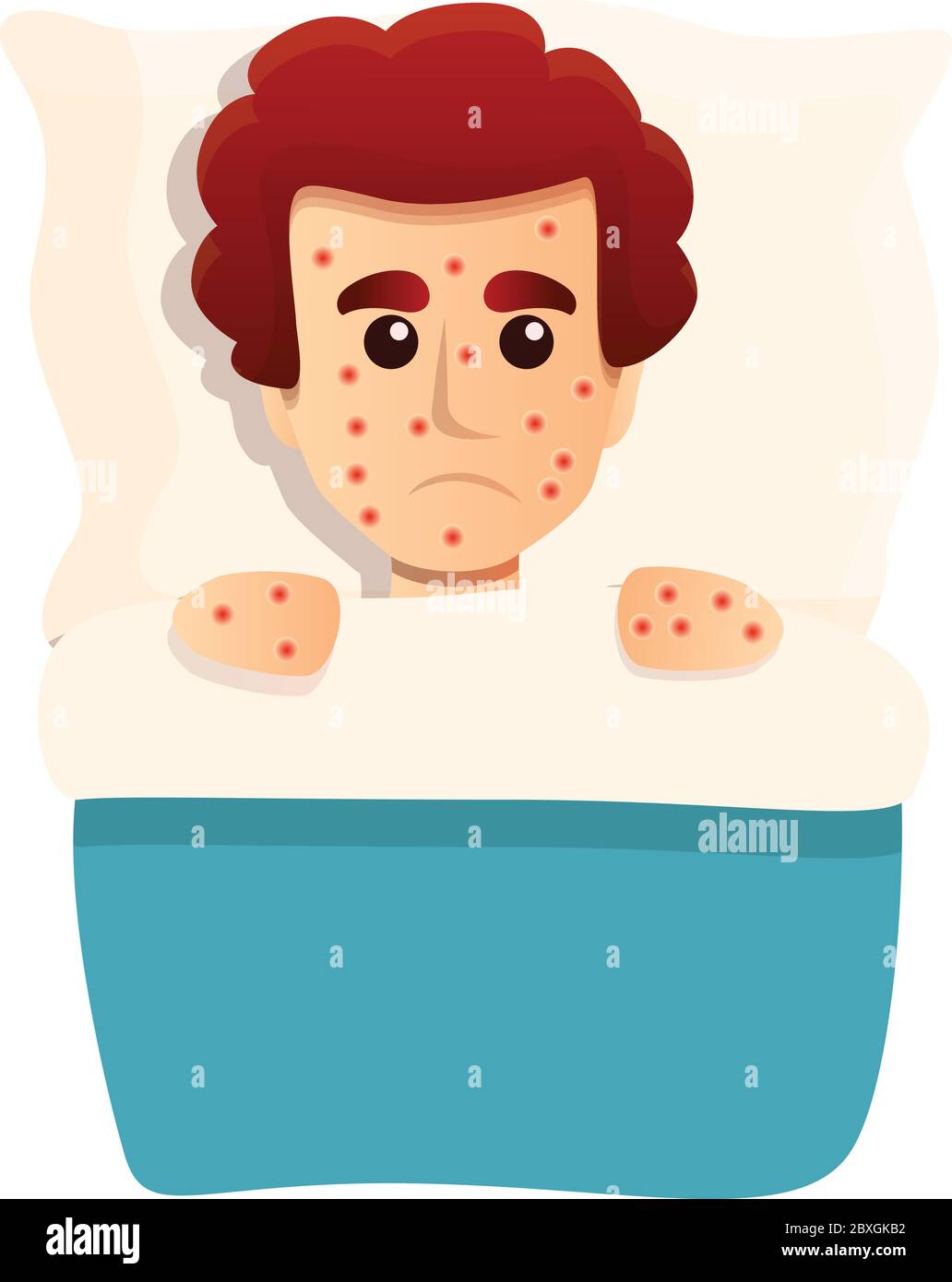 Chicken pox patient icon. Cartoon of chicken pox patient vector icon ...