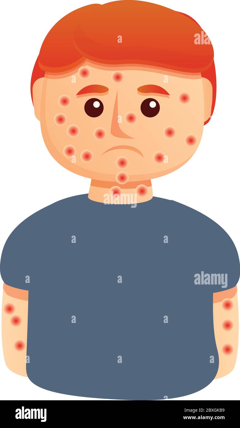 Chicken pox boy icon. Cartoon of chicken pox boy vector icon for web ...