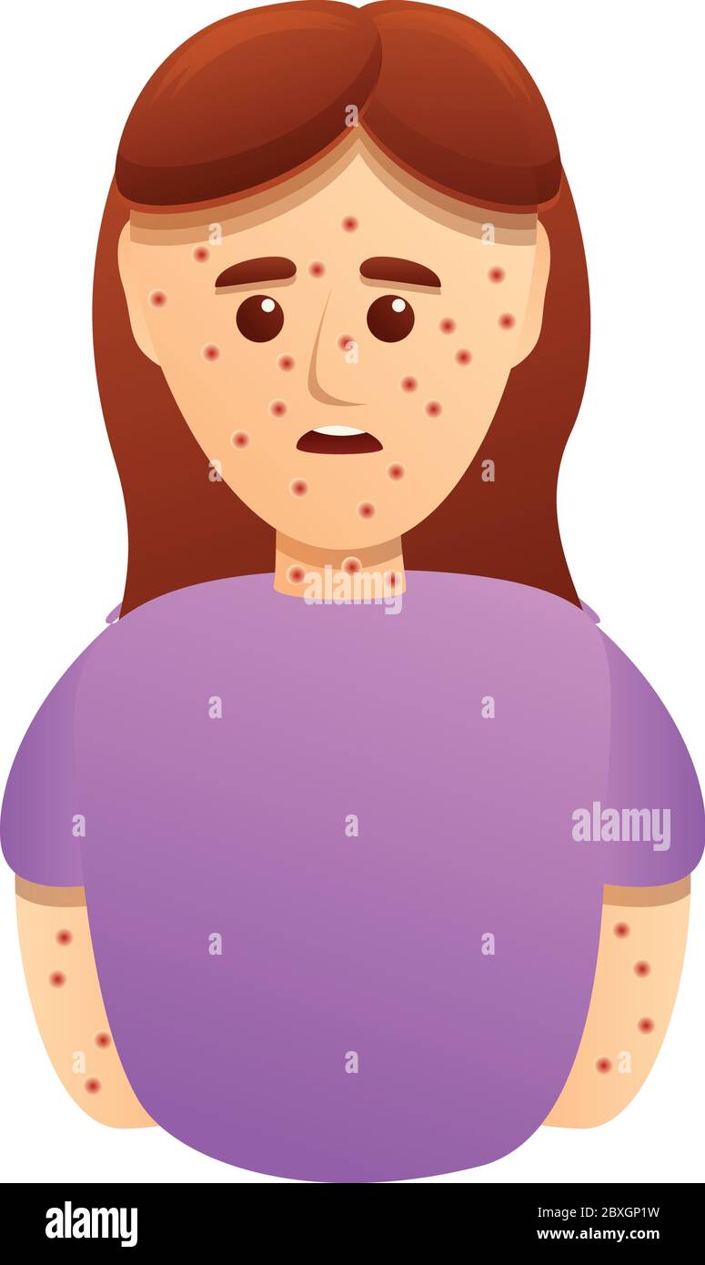 Chicken pox sick girl icon. Cartoon of chicken pox sick girl vector ...