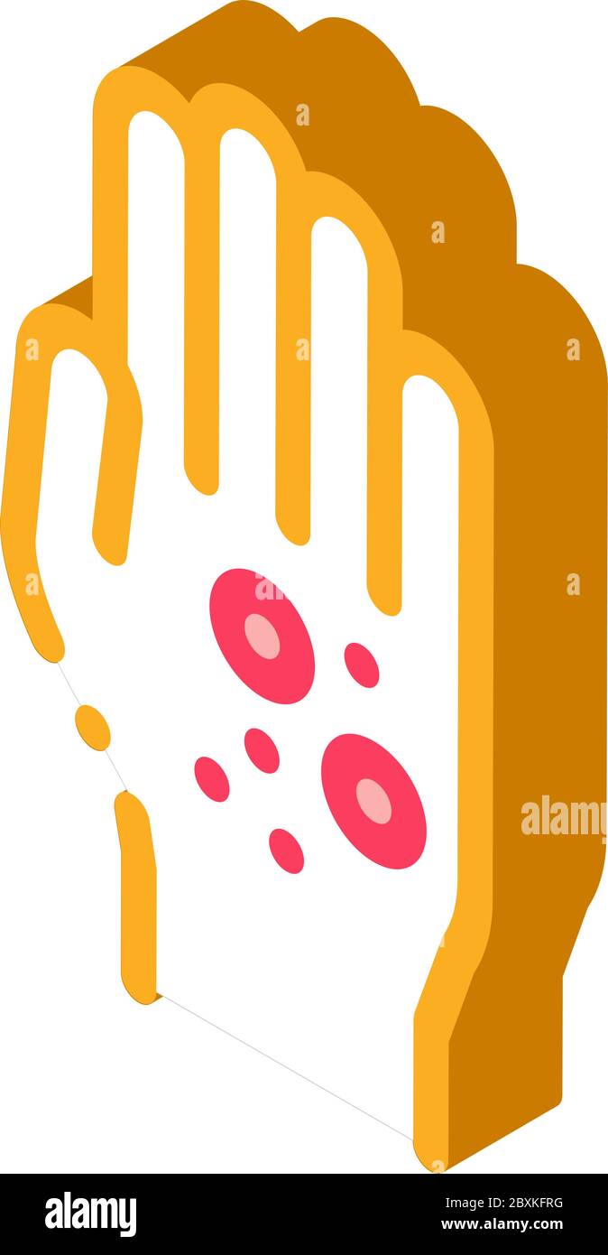 Dermatitis Rash On Hands Isometric Icon Vector Illustration Stock