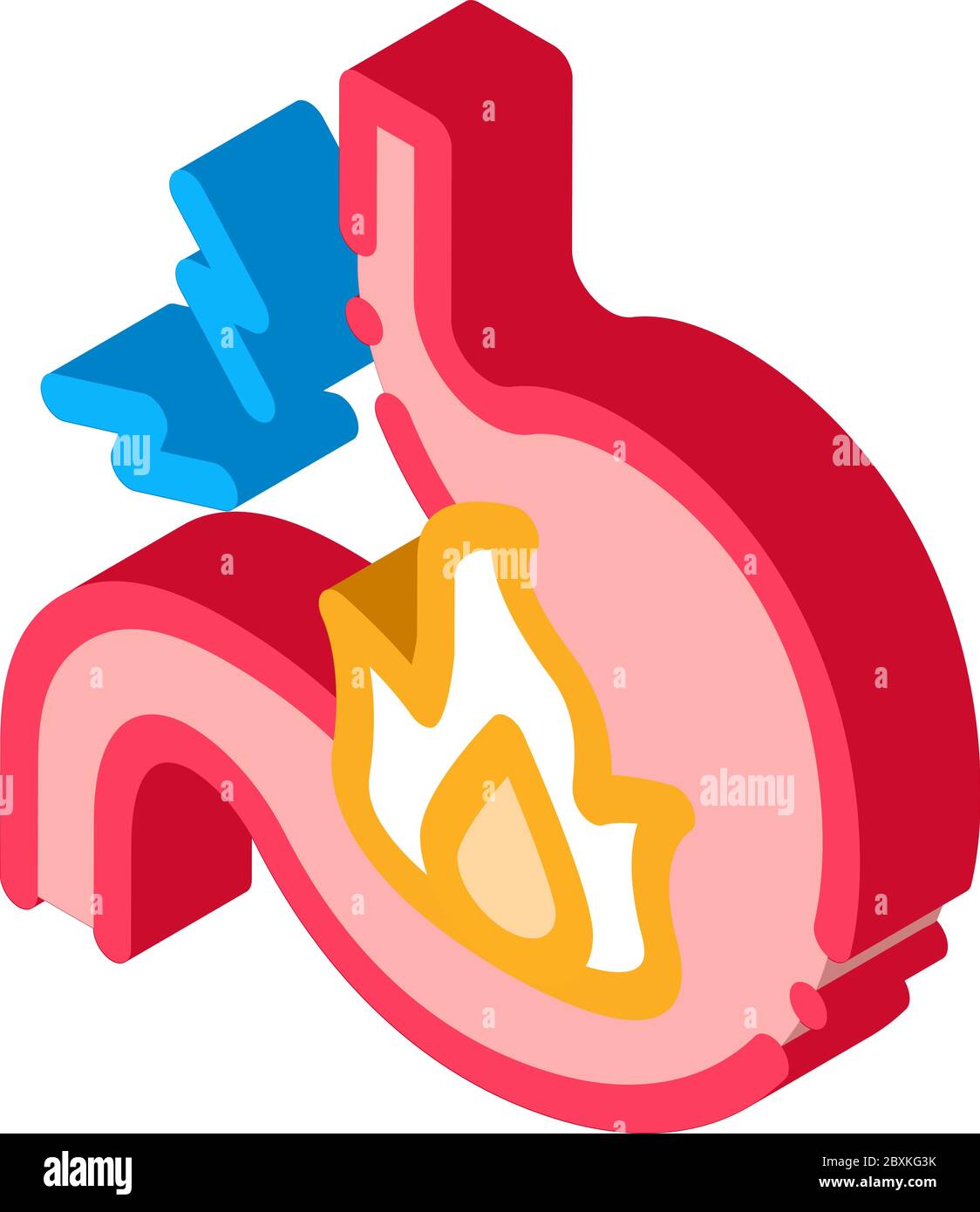severe heartburn stomach pain isometric icon vector illustration Stock ...