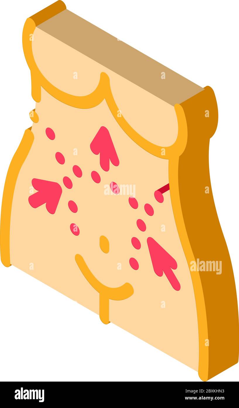 tummy tuck isometric icon vector illustration Stock Vector Image & Art ...