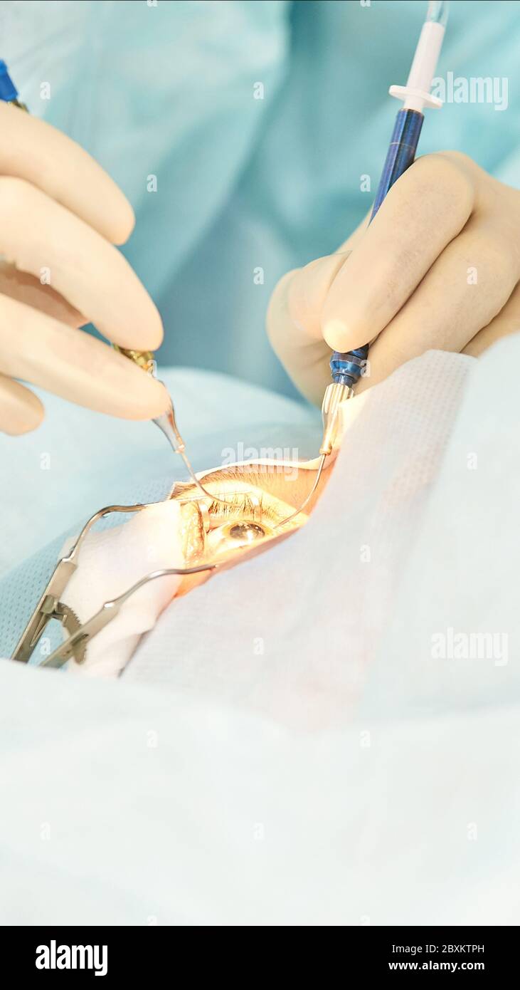 Ophthalmology laser microscope operation. Doctor in clinic. Patient eye ...