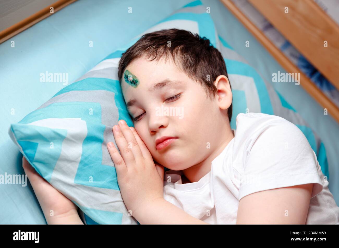 Child with a forehead injury is sleeping. Surgical suture on forehead ...