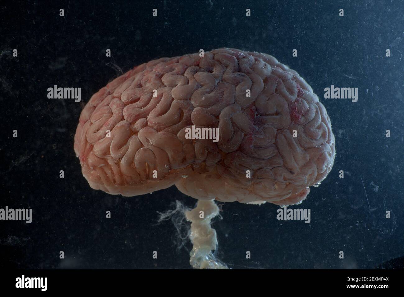 Brain floating in a tank of water Stock Photo - Alamy