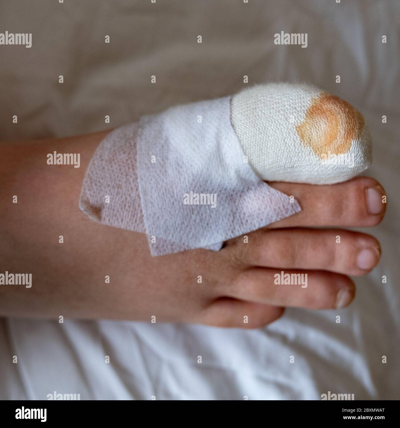 Laura has had one toenail removed and one cut back after three ...