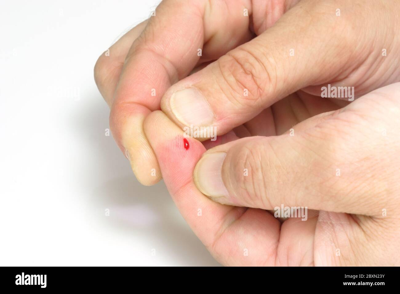 Hand cut blood bleeding hi-res stock photography and images - Alamy