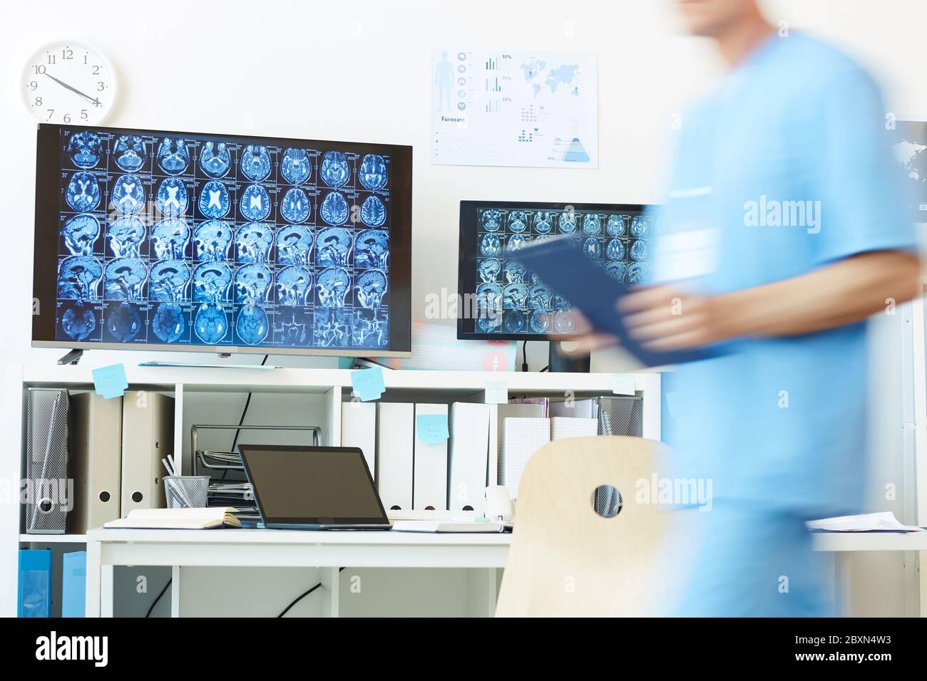 Hospital brain scans hi-res stock photography and images - Alamy