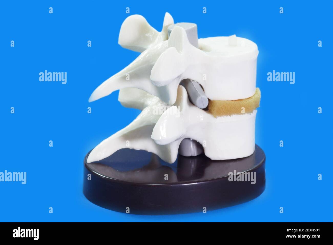 Spine disk hi-res stock photography and images - Alamy