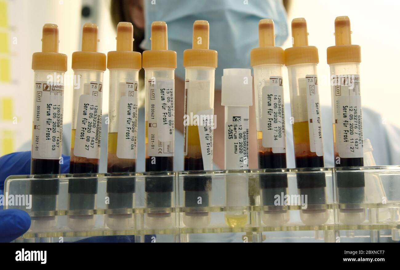 Serum samples hi-res stock photography and images - Alamy