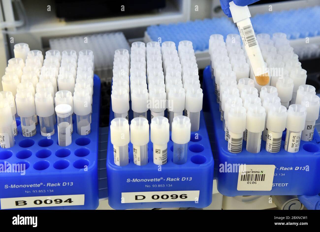 Leipzig, Germany. 20th May, 2020. Serum samples are prepared for an ...