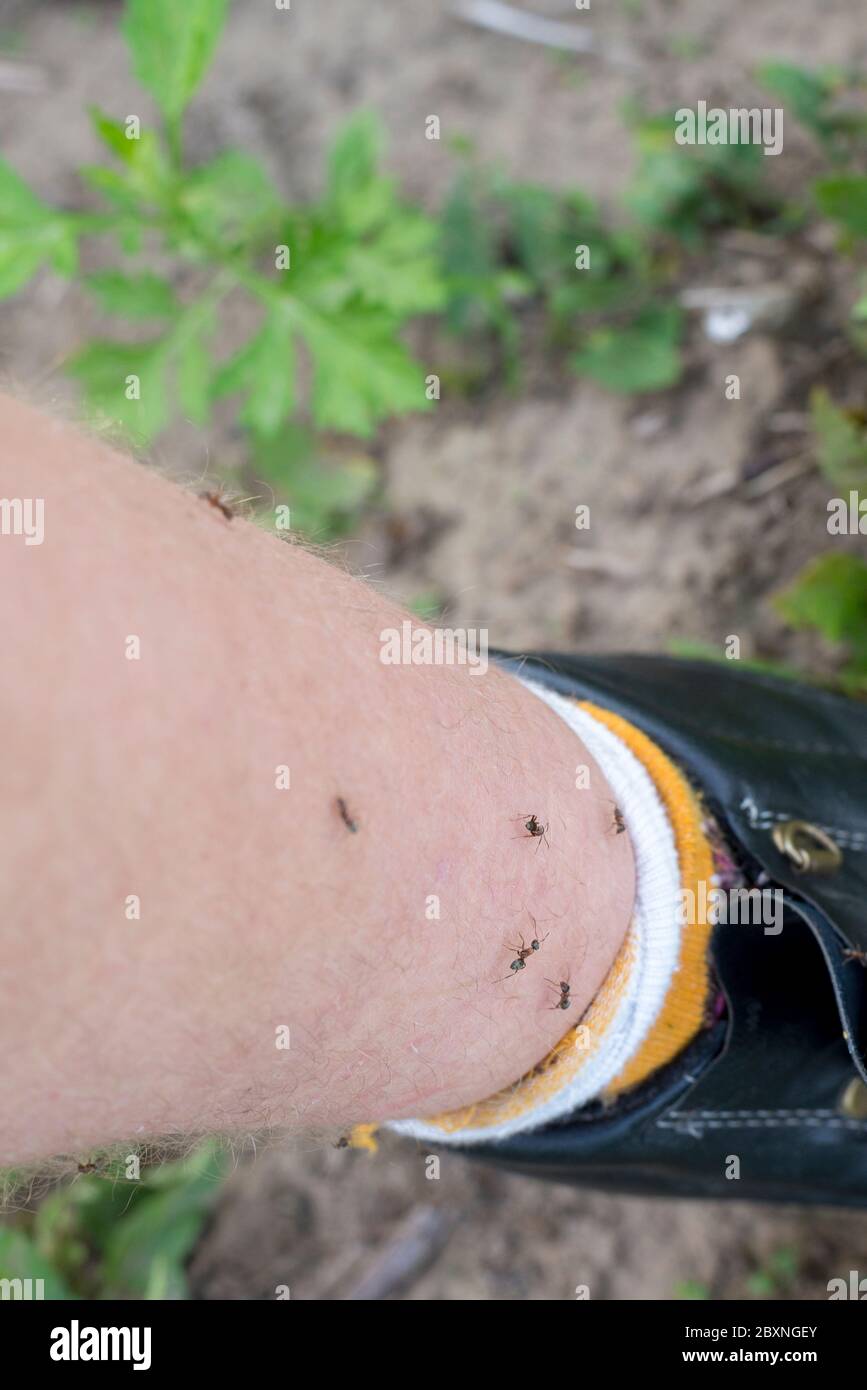 Several little ants on the foot of a man, the theme of insect bites, a ...