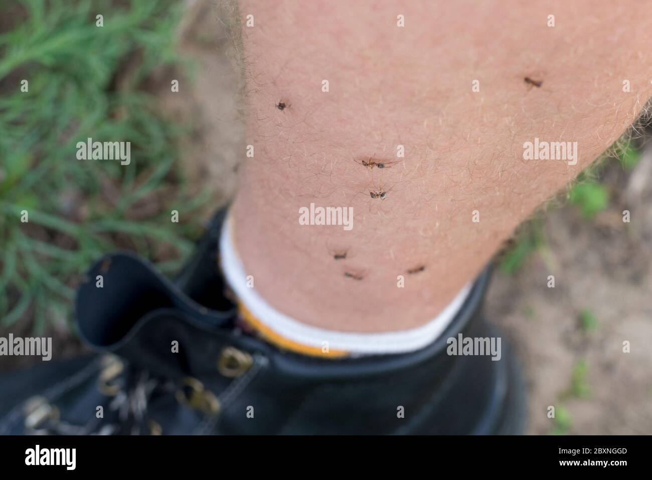 Ant bites skin hi-res stock photography and images - Alamy