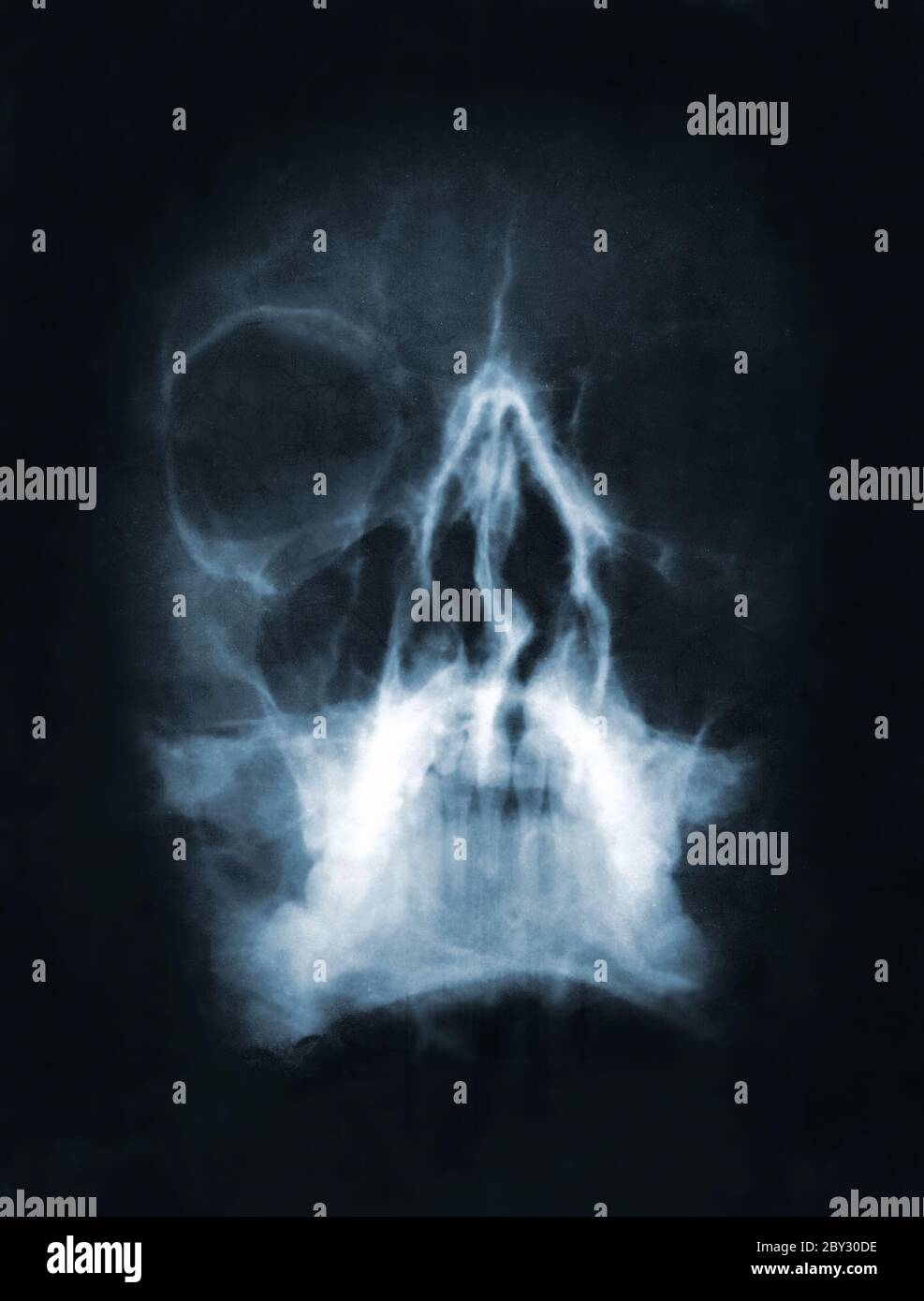 Front skull x ray image hi-res stock photography and images - Alamy