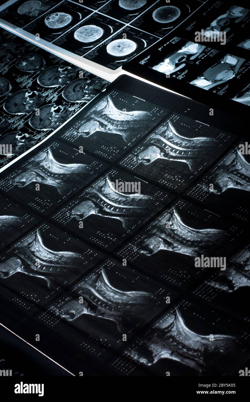 Tomography scan neck hi-res stock photography and images - Alamy