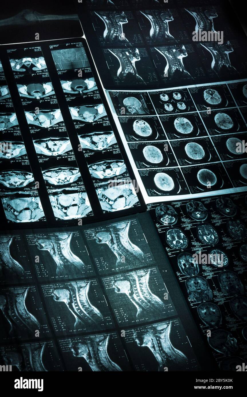 Xray emission hi-res stock photography and images - Alamy