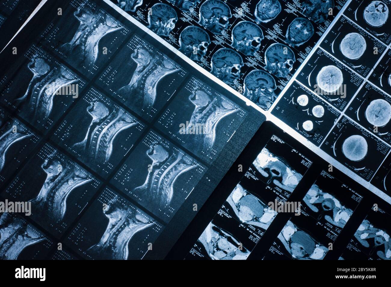 Ct scan report of head and neck hi-res stock photography and images - Alamy