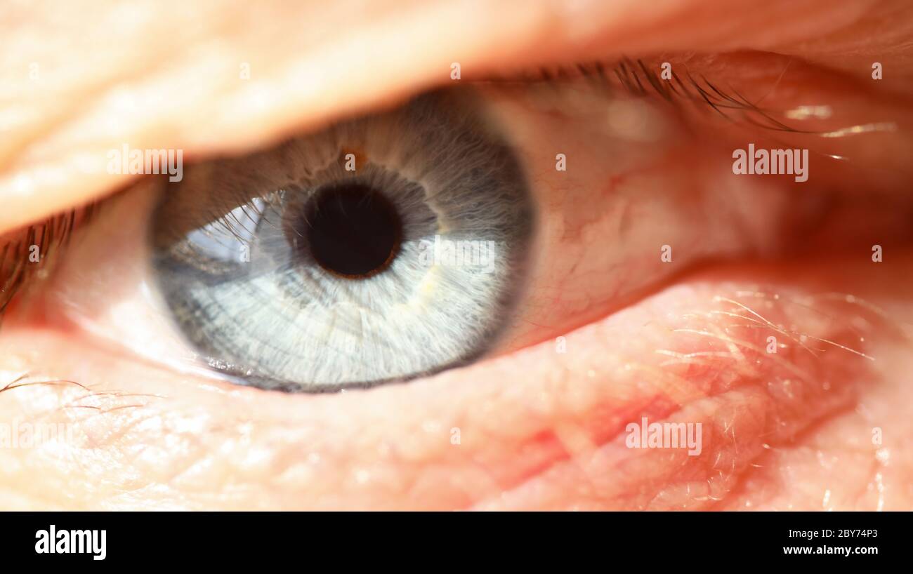 Iridology hi-res stock photography and images - Alamy
