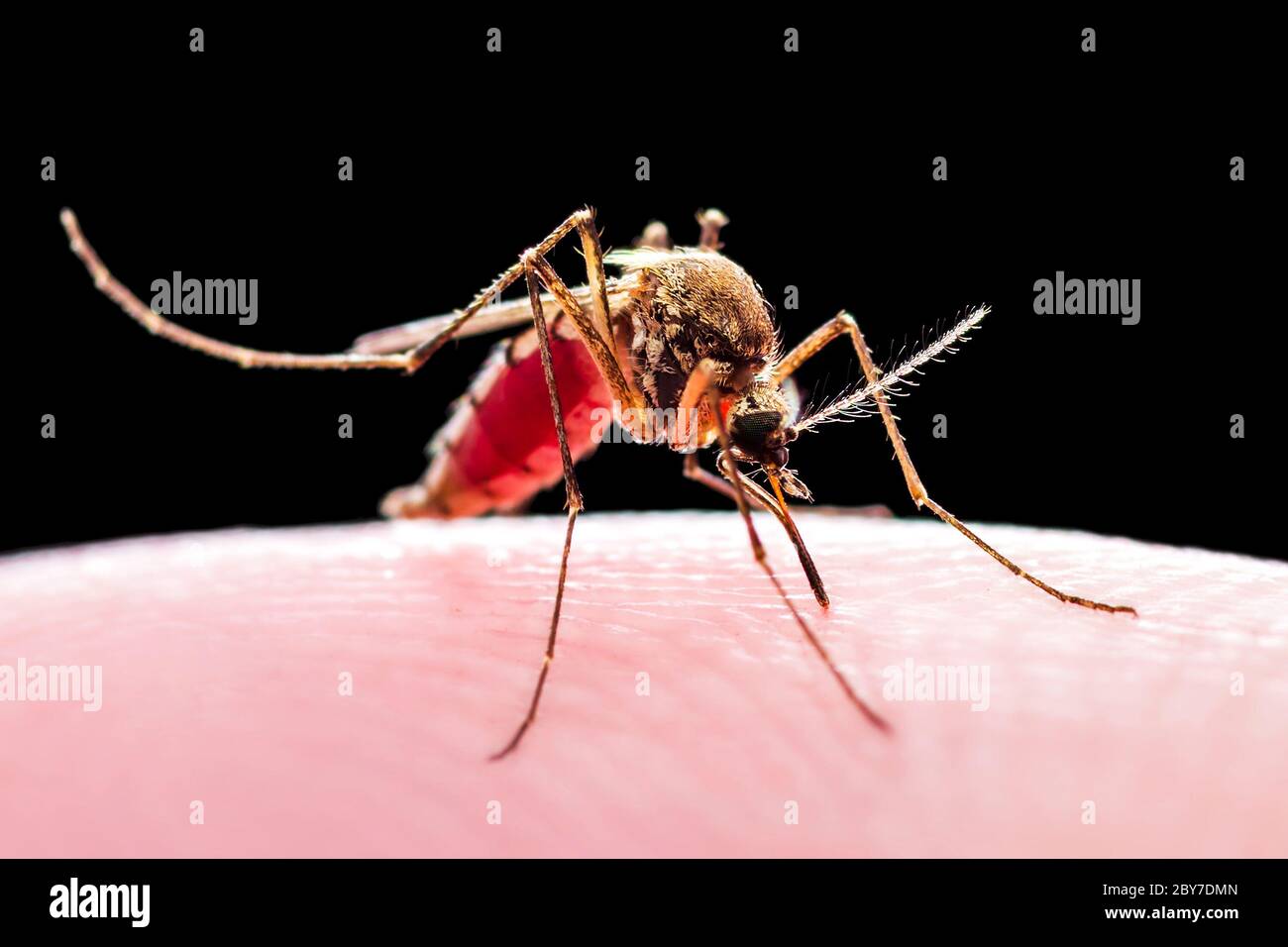 Encephalitis, Yellow Fever, Malaria Disease or Zika Virus Infected ...
