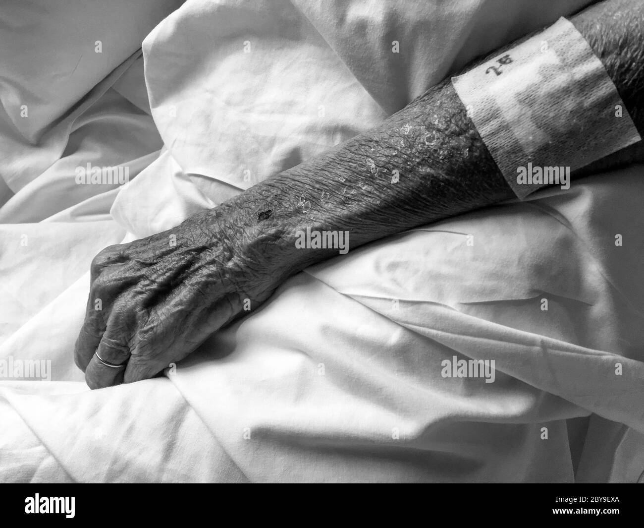 Wrinkled arm of a 92 years old man, Hospital room, Lyon, France Stock ...