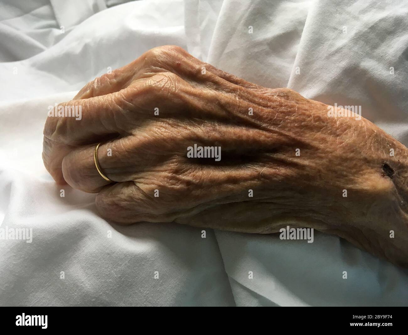 "END of LIFE", Photo essay on a man at end-of-life, Lyon, France Stock ...