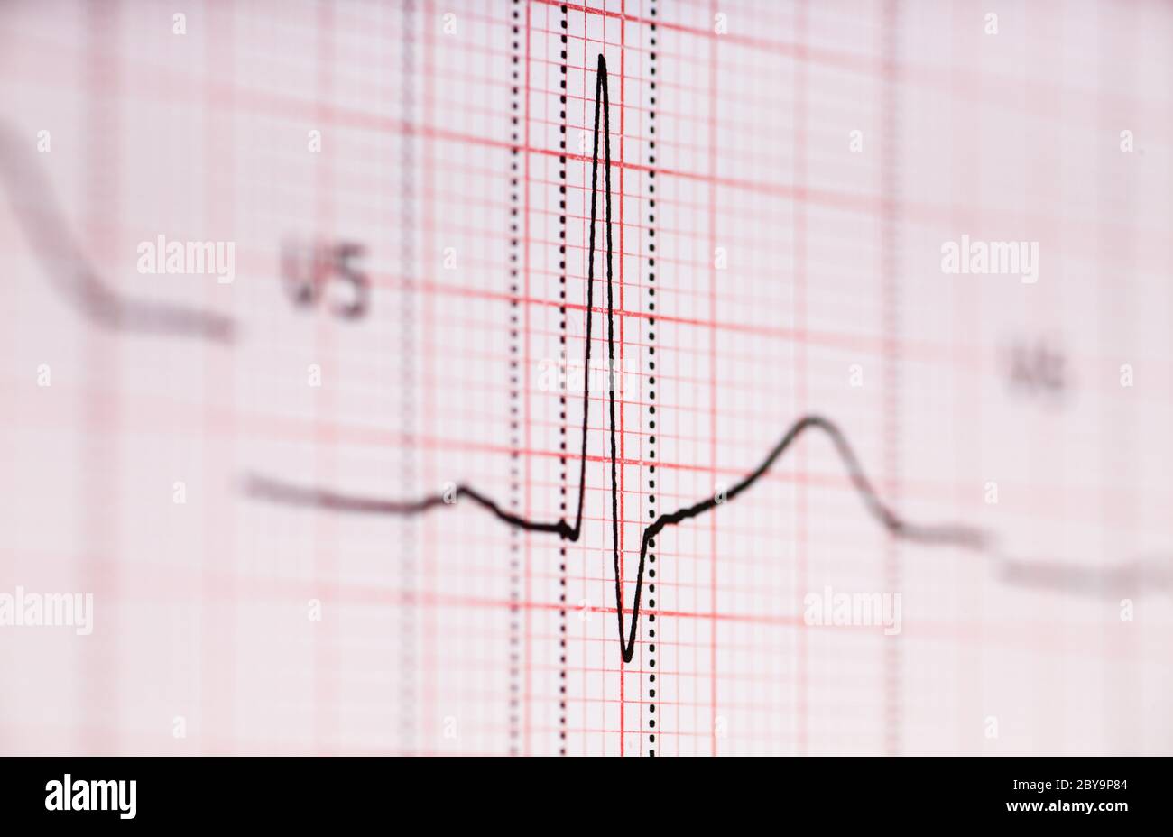 Ecg graph hi-res stock photography and images - Alamy