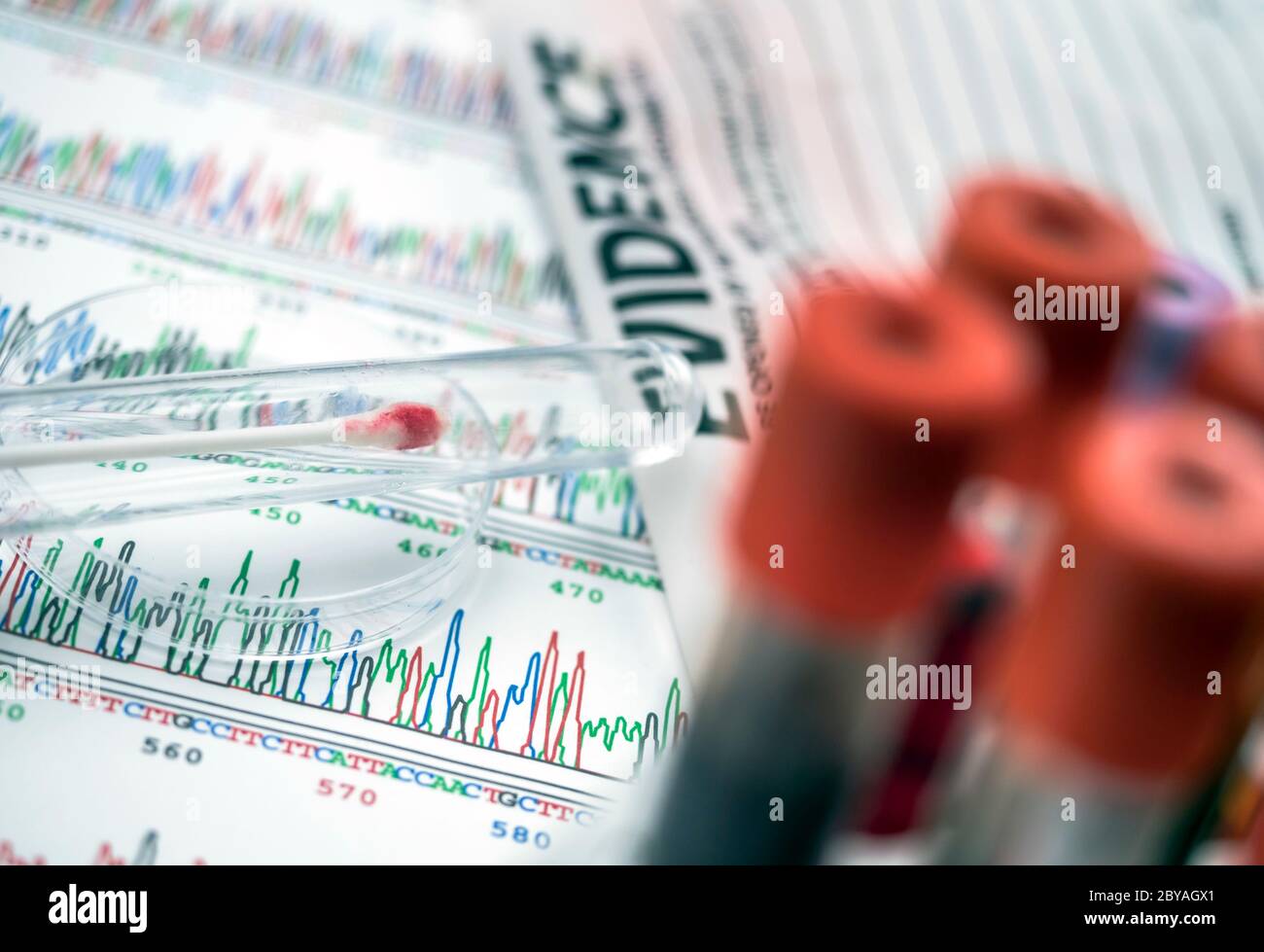 Hematological analysis with forensic test kit in a murder in a crime ...