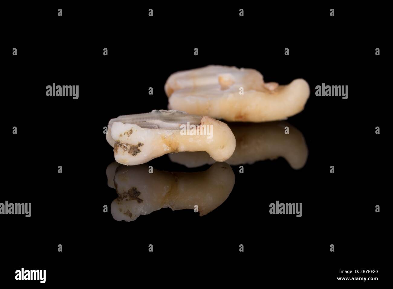 Mandibular Third Molar