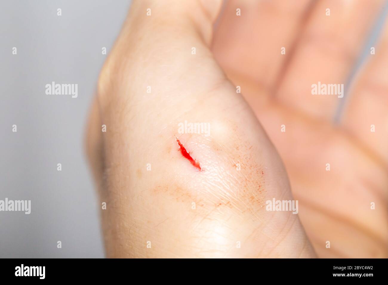 Aid accidental hi-res stock photography and images - Alamy