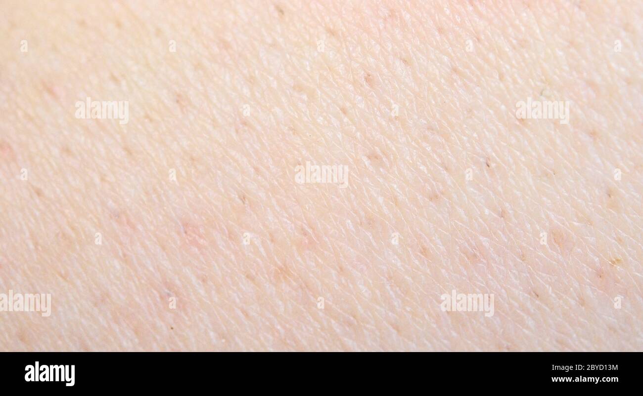 Dermatology detailed hi-res stock photography and images - Alamy