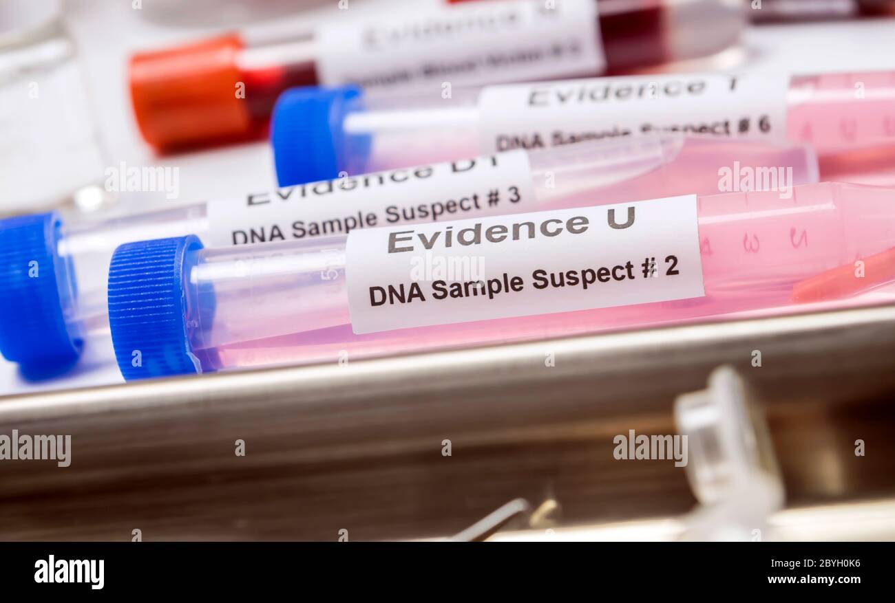 Hematological analysis with forensic test kit in a murder in a crime ...