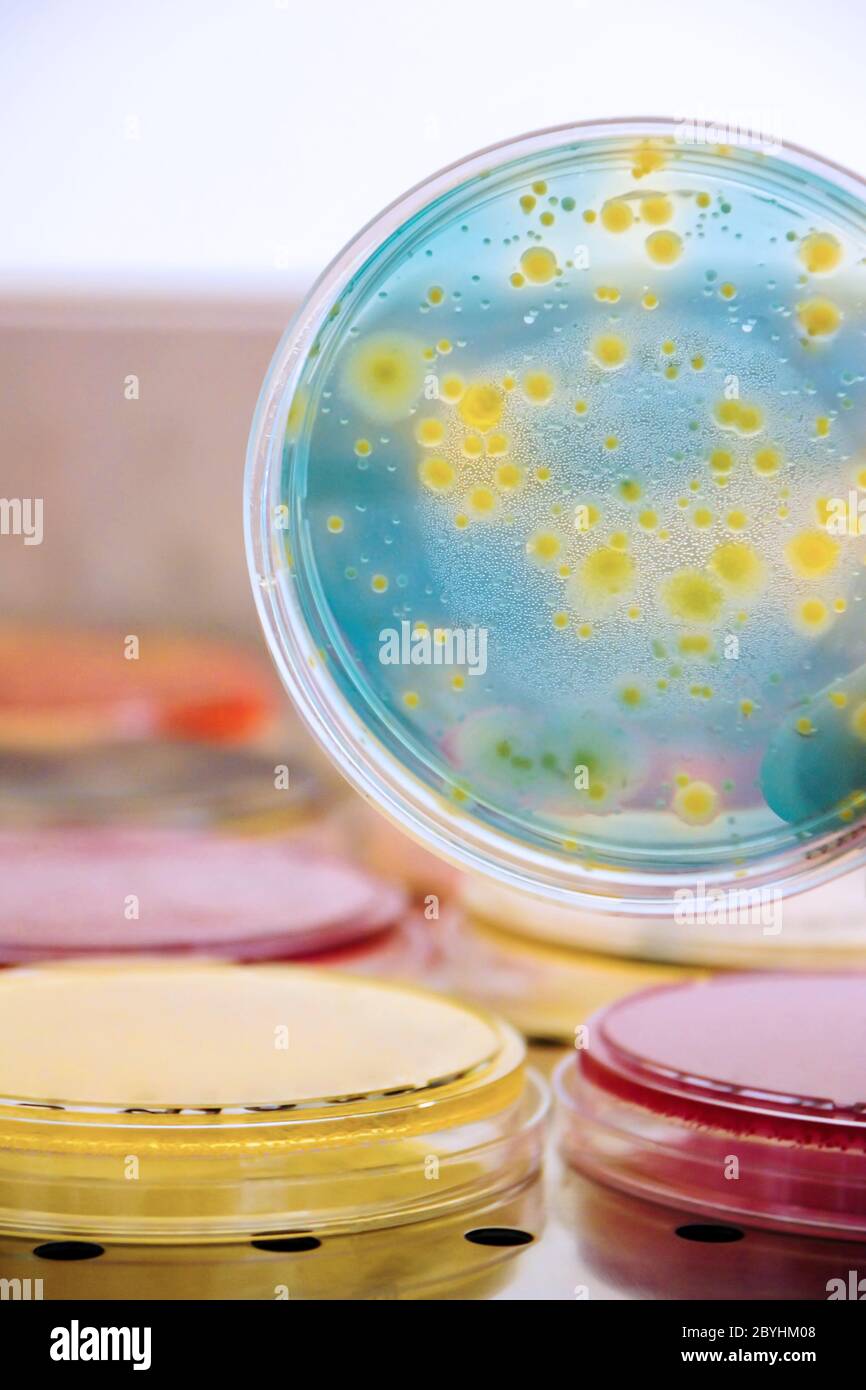 Escherichia Coli Colonies High Resolution Stock Photography and Images ...