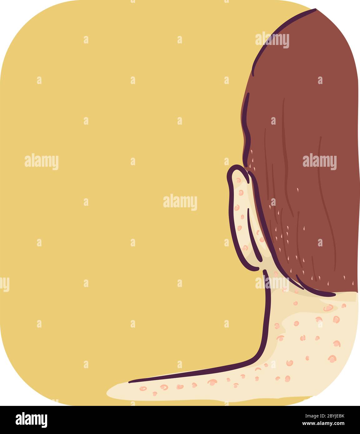 Illustration Of A Man With Red Bumps On Head And Neck Lice Bites Stock Illustration Of A Man With Red Bumps On Head And Neck Lice Bites Stock